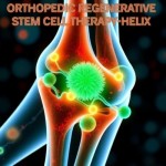 Orthopedic Regenerative Stem Cell Therapy-Helix - Helix Health Science ...